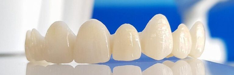 Common Questions About Zirconia Teeth | Full Mouth Dental Implants